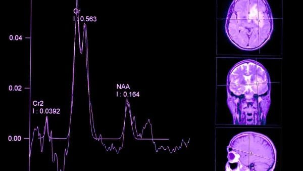 Understanding the Basics of FTIR Spectroscopy: A Comprehensive Guide ...